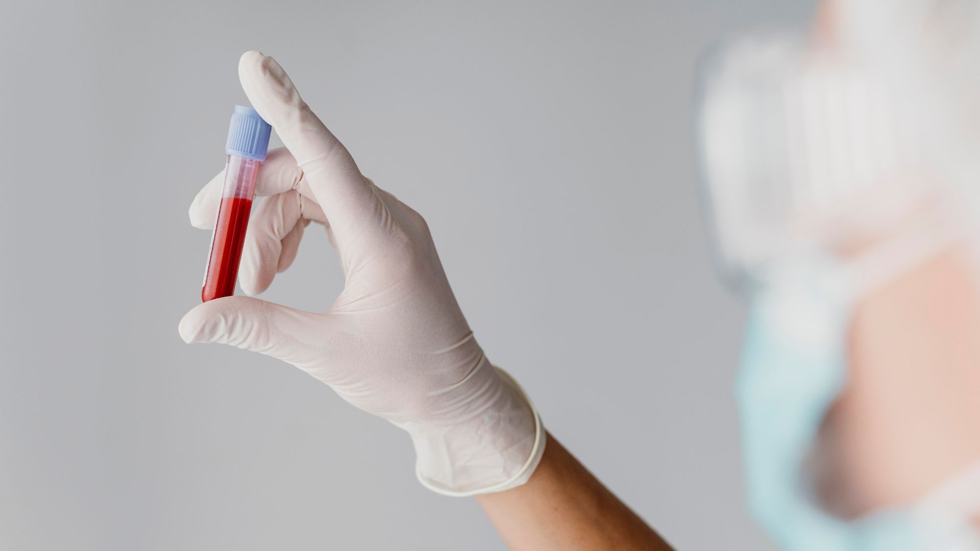 Exames de coagulação: quando devem ser realizados? • LabVital